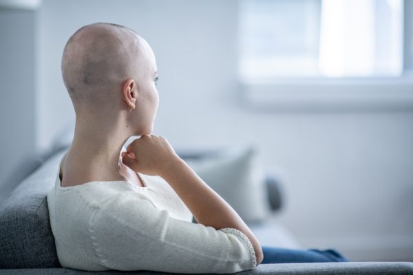 Everything You Need To Know About Alopecia - 29Secrets